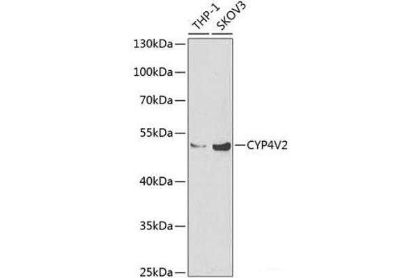 CYP4V2 Antibodies